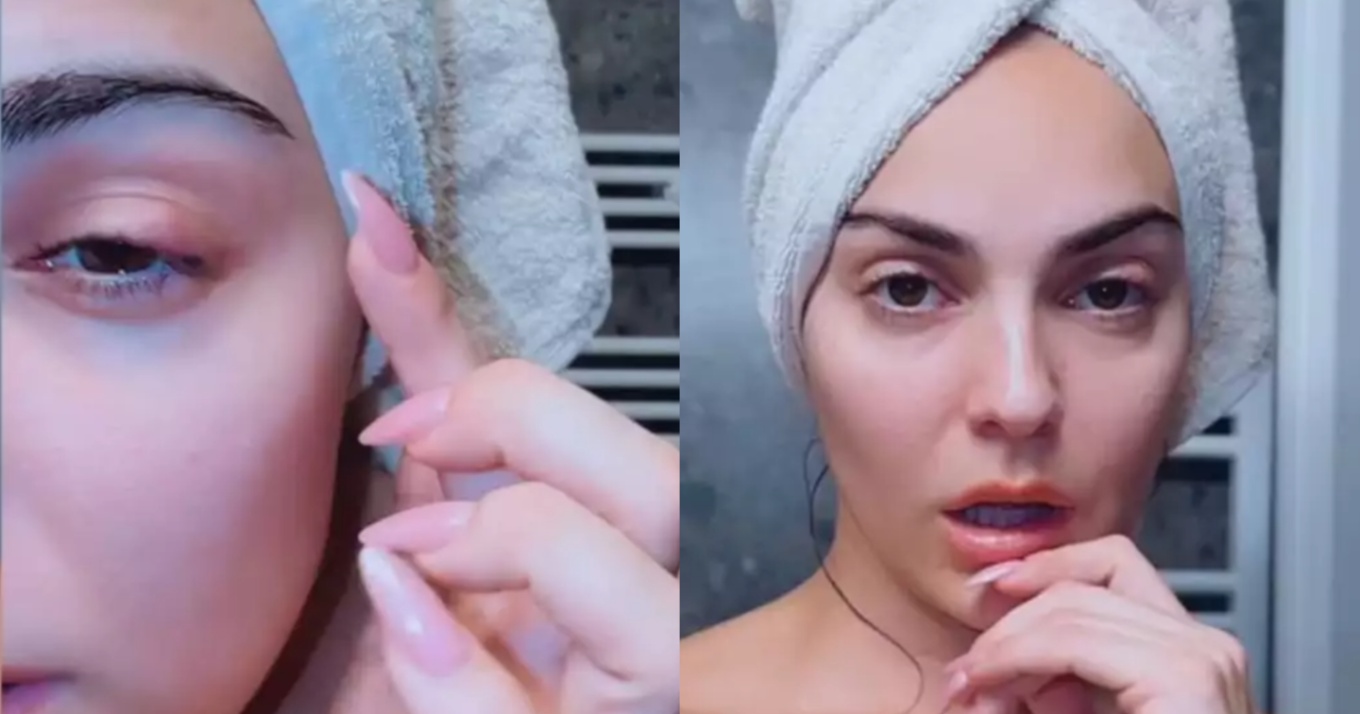 Ανησυχία για την Βρισηίδα Ανδριώτου: Εμφανίστηκε με πρησμένο μάτι, μέσα στην τουαλέτα, σε βίντεο ...